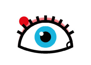 Chalazion - The eyes of children